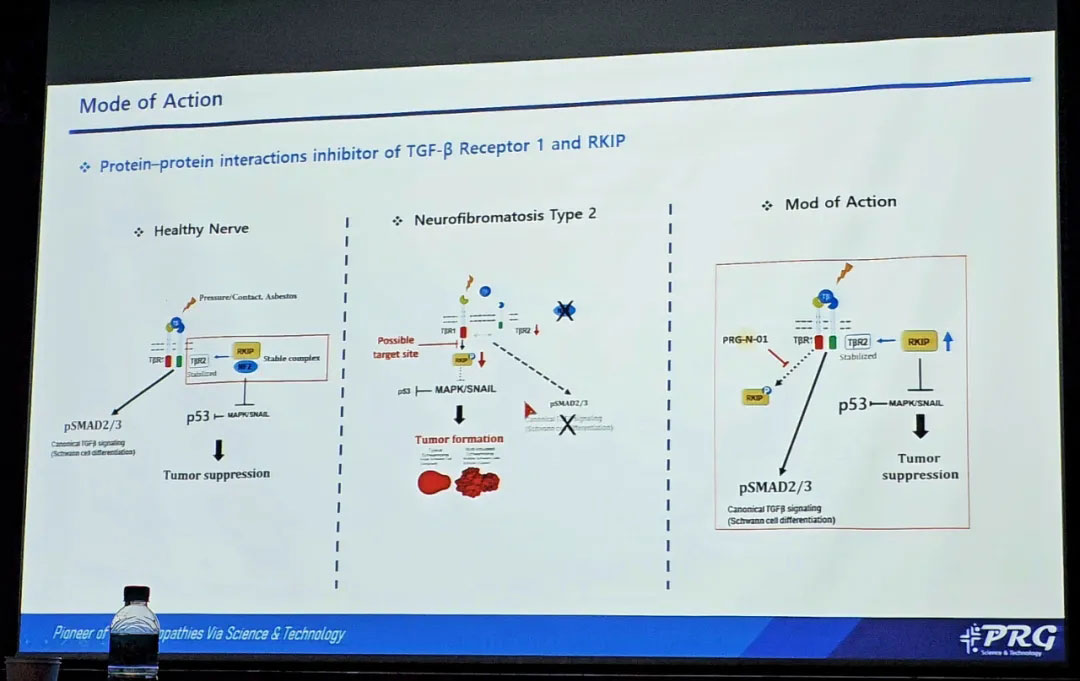PRGS&Tech 计划今年在韩国开始针对 2 型神经纤维瘤病患者的临床试验_泡泡家园神经纤维瘤病关爱中心